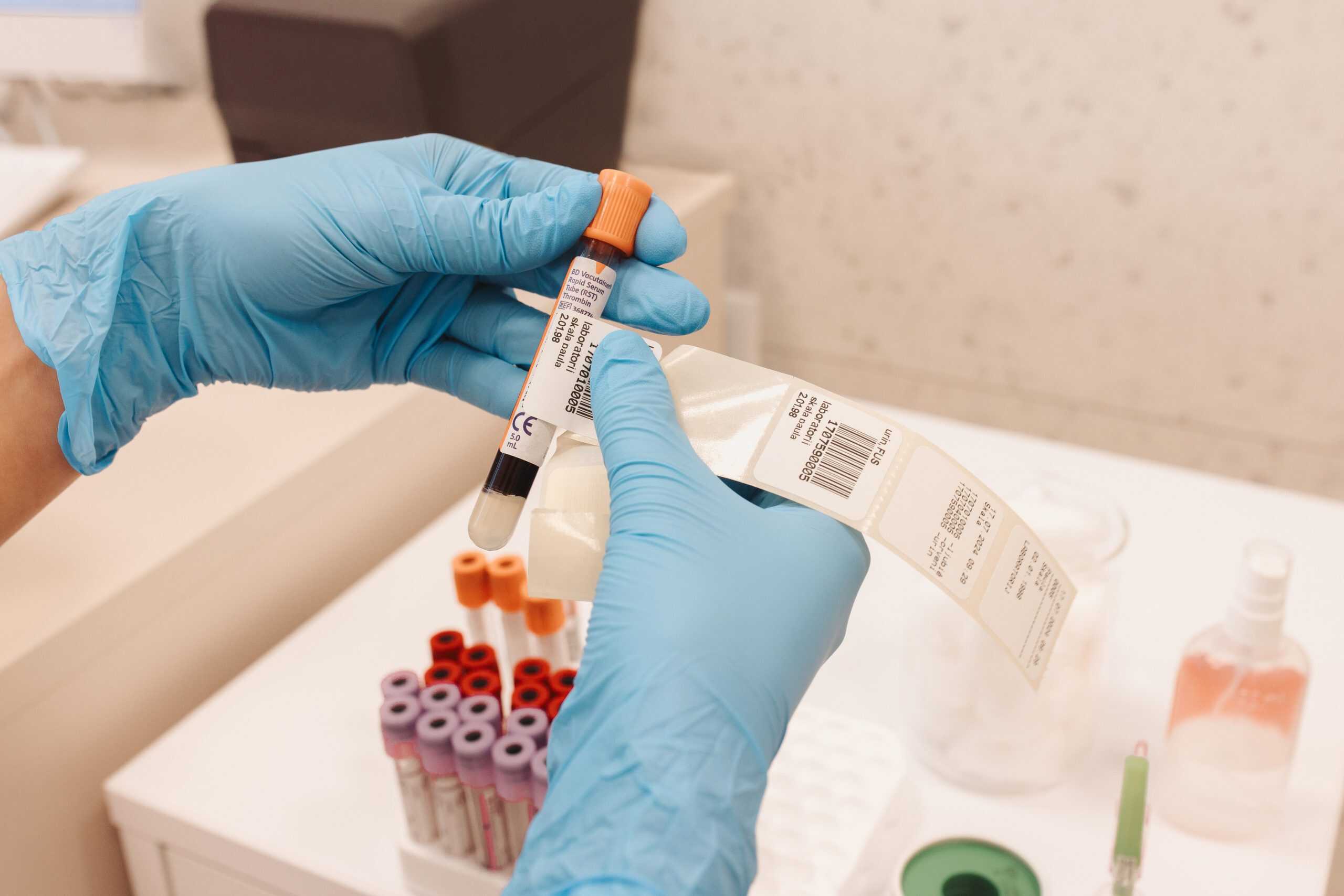 ALEX2 – advanced allergy test - IMC Priora Čepin